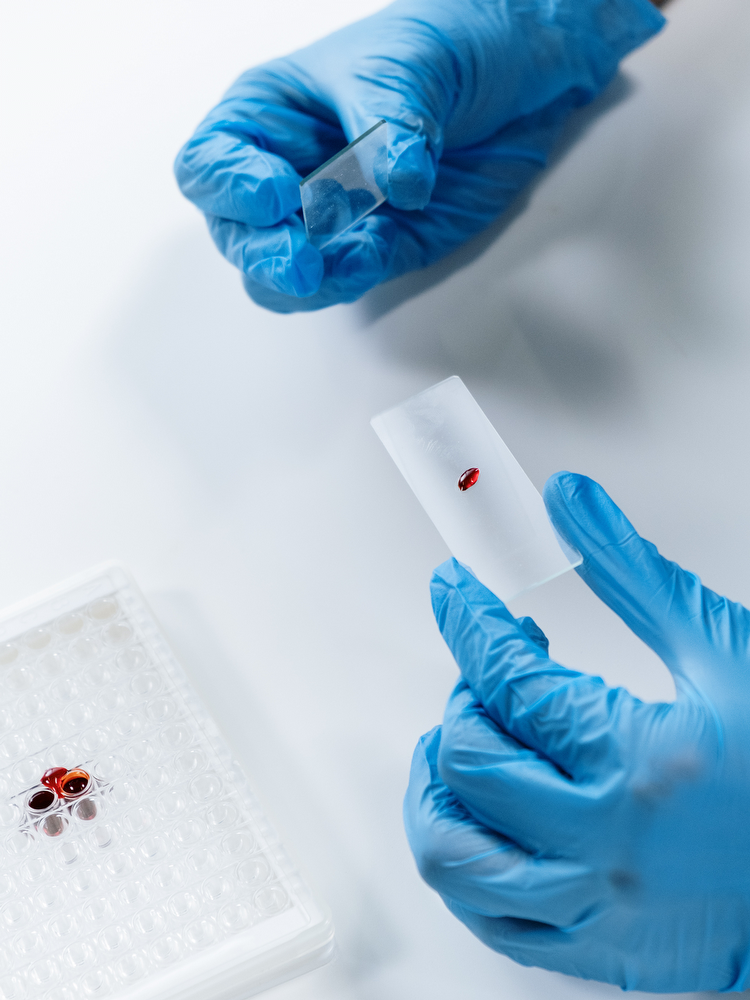 Iron Status - BlueIron